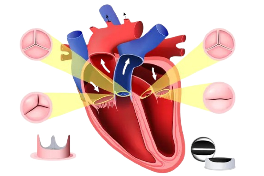 Keyhole Heart Surgery-With Small Incisions Come Great Responsibilities